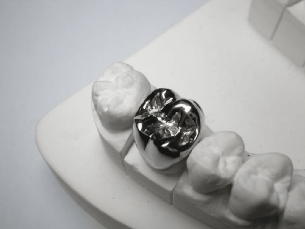 Full Cast Outsourcing Guide: How to Outsource Crown and Bridge from China?